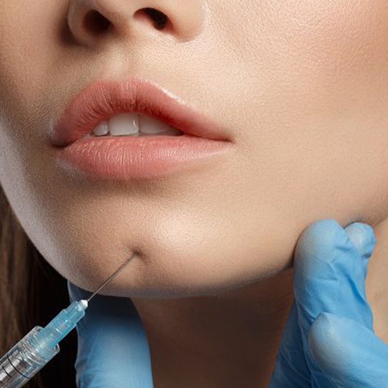 Face Fillers – Thekliniceg, Dr. Mounir William